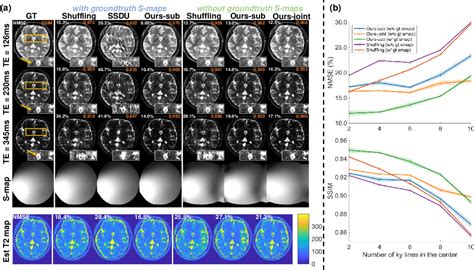 Zero Shot Self Supervised Joint Temporal Image And Sensitivity Map