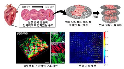 포스텍 인공심장 근육 패치 개발심근경색 환자의 심장 기능 개선에 효과 전자신문