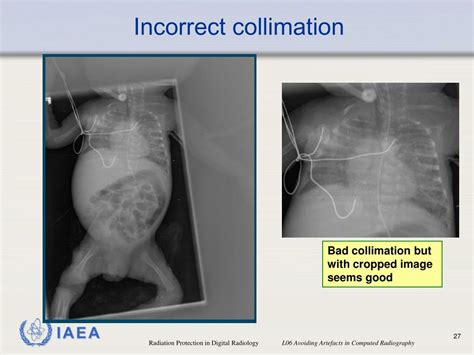 Ppt Radiation Protection In Digital Radiology Powerpoint Presentation Id 3198988
