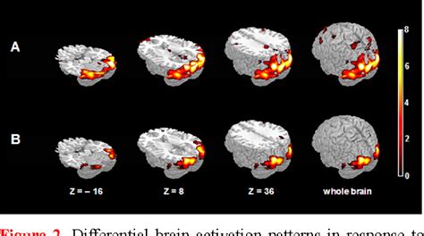 figure 2 from brain activation patterns associated with sexual