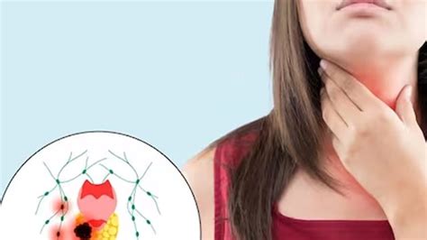 When Thyroid Messes With Sex Life A Guide To Healthy Sex Life News18