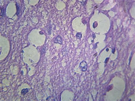 Gsc International Ps0263 Human Cerebral Cortex Section Microscope