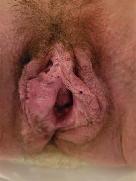 Swollen Pussy Pic