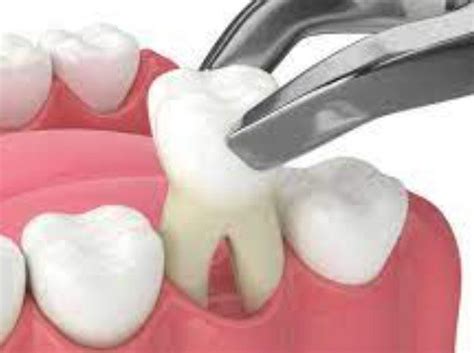 Tooth Grinder Dentin Grinder