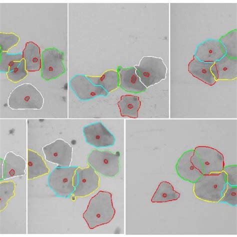 A The Boundaries Of The Cell Cluster And The Nuclei After The Nuclei