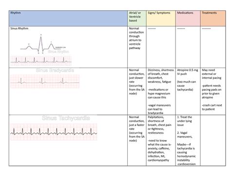 Rhythm Cheat Sheet 1 Rhythm Atrial Or Ventricle Based Signs