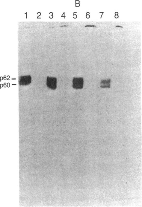 Characterization Of C Myc Protein Synthesis In S Cerevisiae Yeast