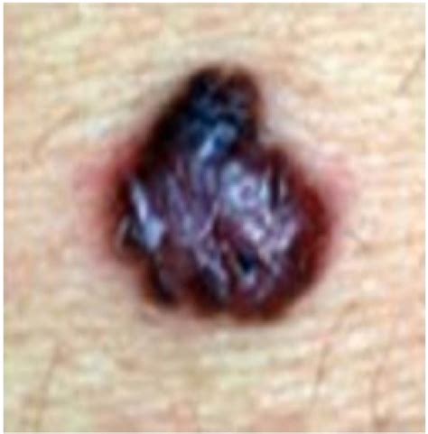 Otsu Segmentation Method Otsu Shows That Minimizing The Inter Class Download Scientific Diagram