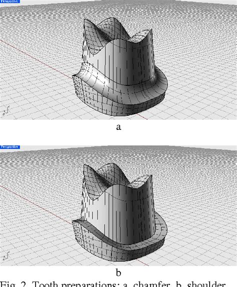 Figure 1 From Finite Element Analysis Of Molars Restored With Ceramic Crowns Semantic Scholar