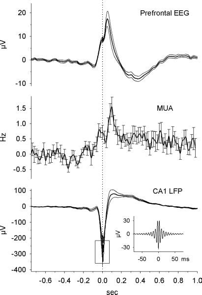 Sharp Wave Ripple Complex Averages Of Original Wideband Recorded Eeg Download Scientific