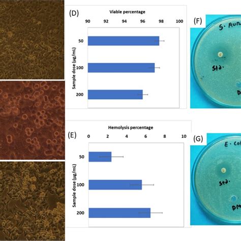 Evaluation Of A Cell Viable Image At 50 μg Ml⁻¹ B Cell Viable Download Scientific Diagram