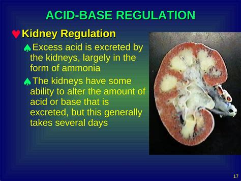 Acid Base Homeostasis Ppt