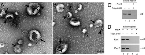 Tem Immunogold Labeling Of The Native Exosomes And Resistance Of