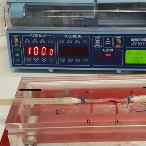 Schematic Of The 3 Steps To Create The Bypass Circuit Download