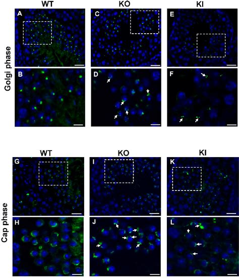 Figure 6 From Single Cell Transcriptomic Profiling Of The Mouse Testicular Germ Cells Reveals