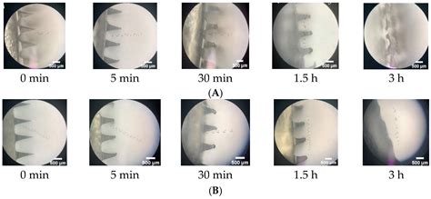 Combination Of Dissolving Microneedles With Nanosuspension And Co Grinding For Transdermal