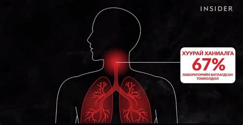 Коронавирусийн халдварын шинж тэмдэг ба өвчлөлийн явц