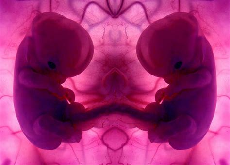 Human Cloning By DonatoCamino On DeviantArt