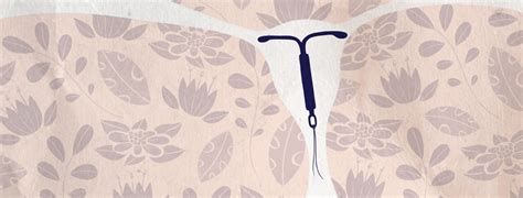Does The Mirena Iud Reduce Endometriosis Symptoms