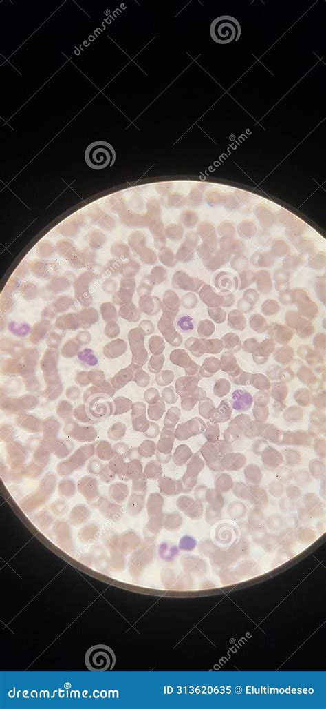 Microscope For Blood And Semen Analysis On A White Background