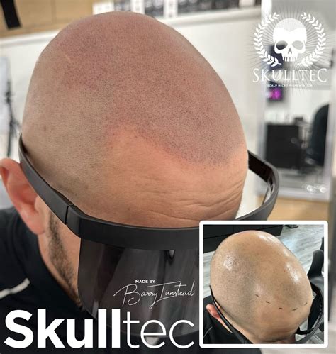 How Can Smp Hair Tattoo Transform Your Appearance Skulltec