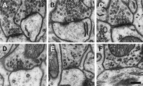 Figures And Data In Ultrastructural Analysis Of Adult Mouse Neocortex Comparing Aldehyde