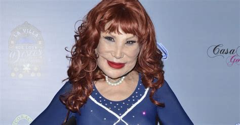 Así Lucía El Rostro De Lyn May Antes De Operarse El Hit Guate