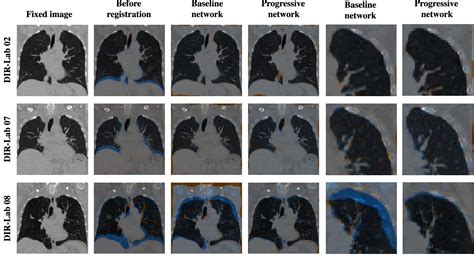 Figure 8 From Progressively Trained Convolutional Neural Networks For Deformable Image