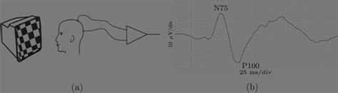 Visual Evoked Potentials A Recording Setup Using Pattern Reversal