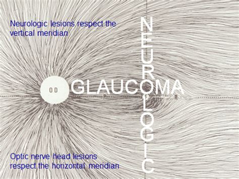 Visual Fields Flashcards Quizlet Visual Fields Flashcards Quizlet