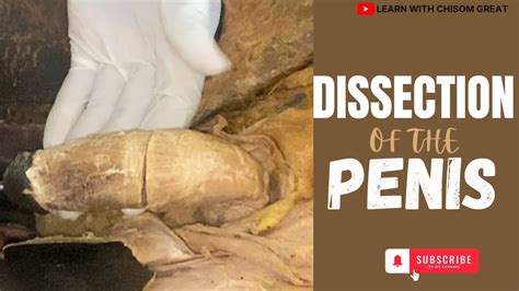 Anatomy Dissection Of The Penis Youtube