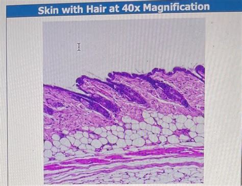 Solved Can You Lable The Epidermidis Dermis Papillary Layers