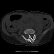 Viewing Playlist Anomalies Radiopaedia Org