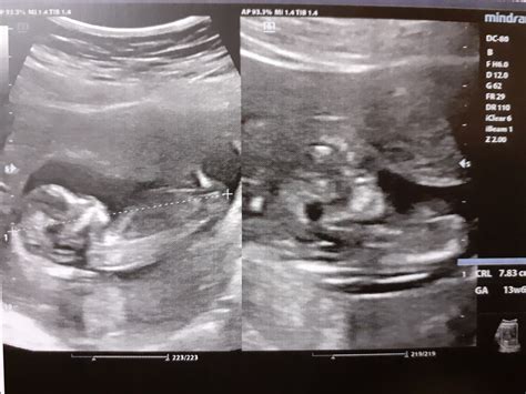 Cant Confirm The Sex Need Help Rcautiousbb