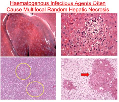 Hepatitis Cholangitis Cholangiohepatitis 2 Flashcards Quizlet