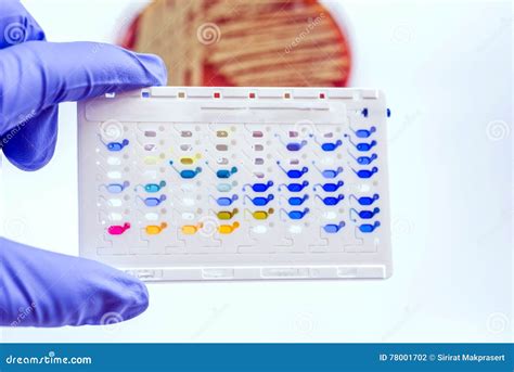 Reagent Strip Test Urinalysis In Laboratory Stock Image Cartoondealer