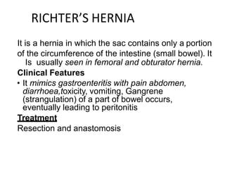 Hernia Pptx