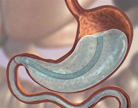 Duodenum What Is The Duodenum