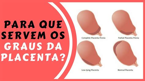Placenta Grau 1 De Grannum Retoedu