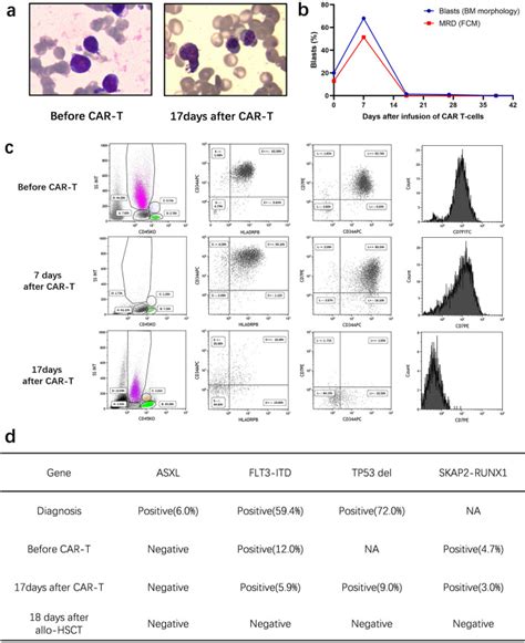 Cd7 Directed Car T Cell Therapy A Potential Immunotherapy Strategy For