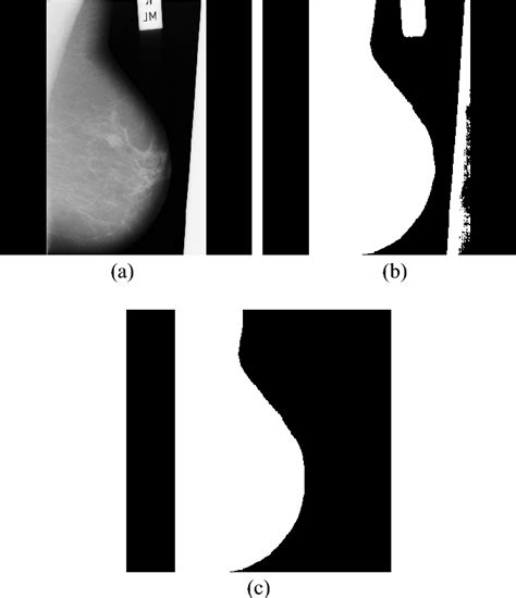 Figure 1 From Feature Selection For Automatic Breast Density Classification Semantic Scholar