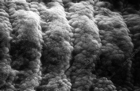 Iris Pigment Epithelium Sem Stock Image C0433760 Science Photo