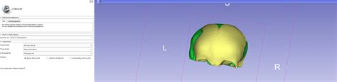 Model To Model Distance Support 3d Slicer Community