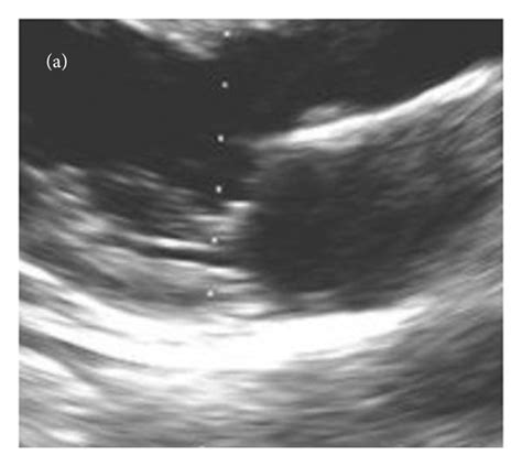 Feature Point Extraction Effect Download Scientific Diagram