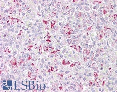 Tet2 Antibody Cat No 42 198 Prosci