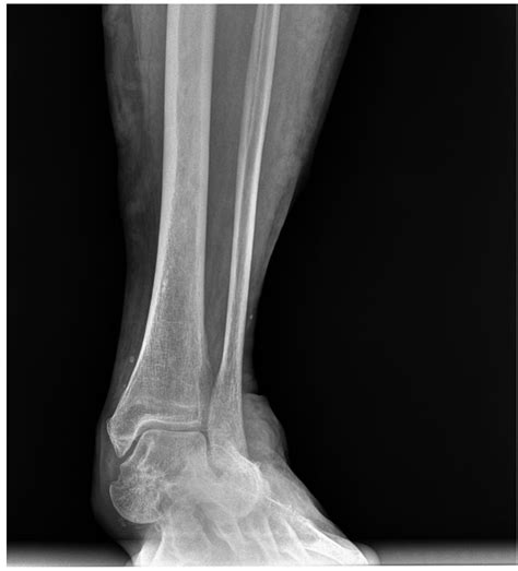 Lets Get This Party Started