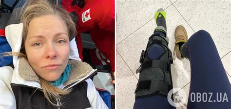 Олена Шоптенко травма Зірка розповіла про нещасний випадок на лижах та операцію на коліні