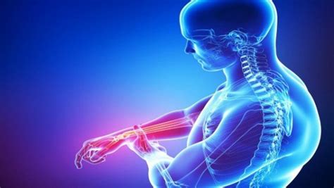 Muscle Weakness Diseases Disorders And Treatment