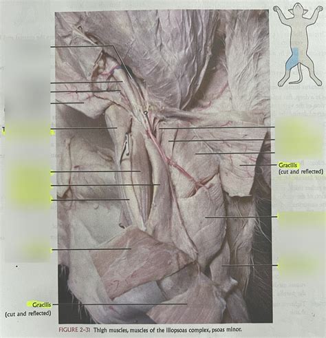 Thigh Muscles Diagram Quizlet Thigh Muscles Diagram Quizlet
