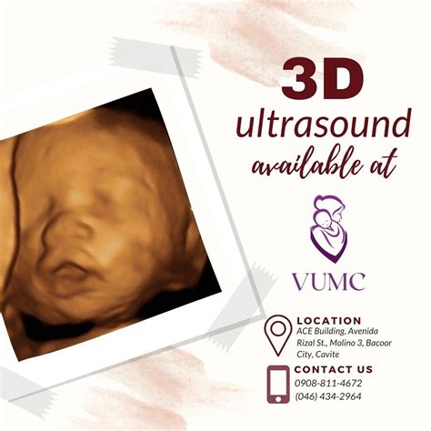 ️ Our 3d Ultrasound Is Available From Monday Saturday ️ You Can Book Your Appointment Thru